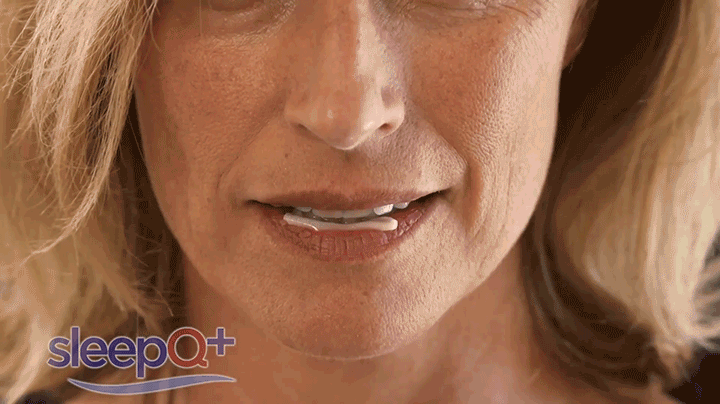 sleepQ+ | Lip Bonding Gel to Stop Mouth Breathing During Sleep